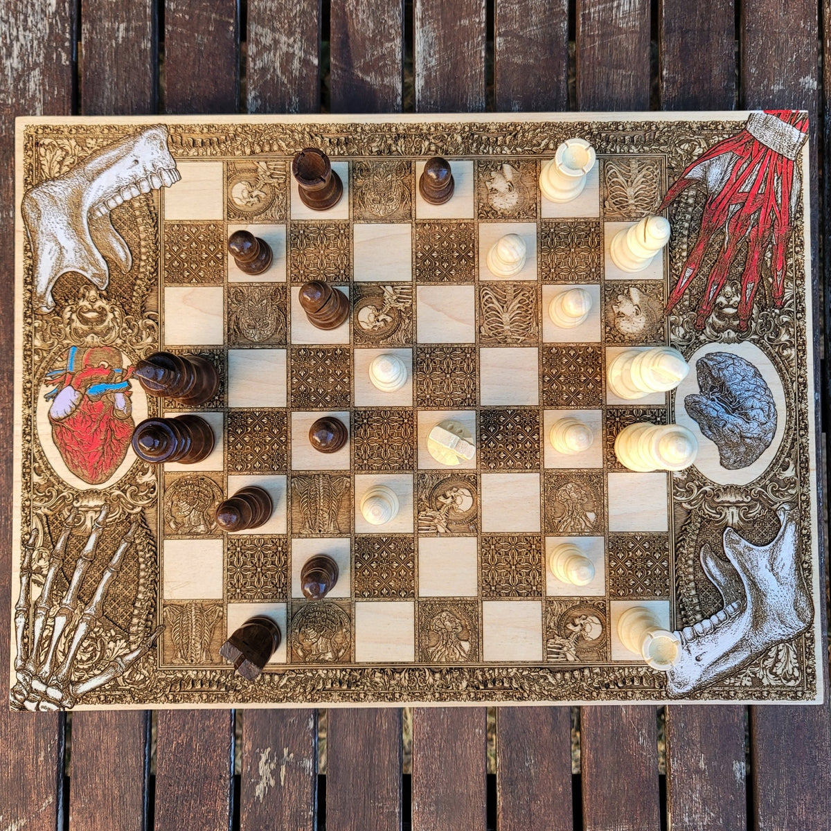 Human Anatomy Chess Board – Laser Engraved, Wood-Stained Gift ...